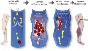 Arterial Lower Extremity Exams – Vascular Center of Michigan